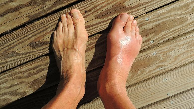 The emotion of disgust has six basic triggers - 3 Quarks Daily