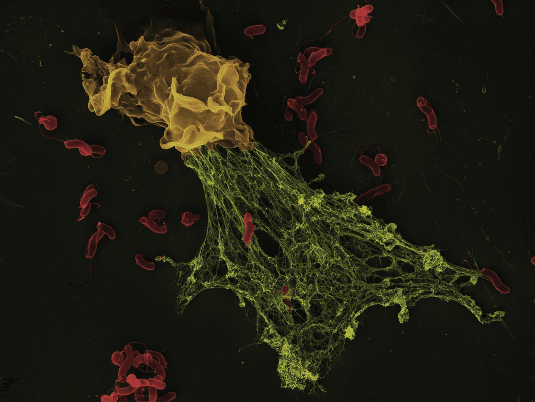 Why Immune Cells Extrude Webs of DNA and Protein - 3 Quarks Daily