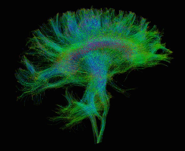 How Human Brains Are Different: It Has a Lot to Do with the Connections ...