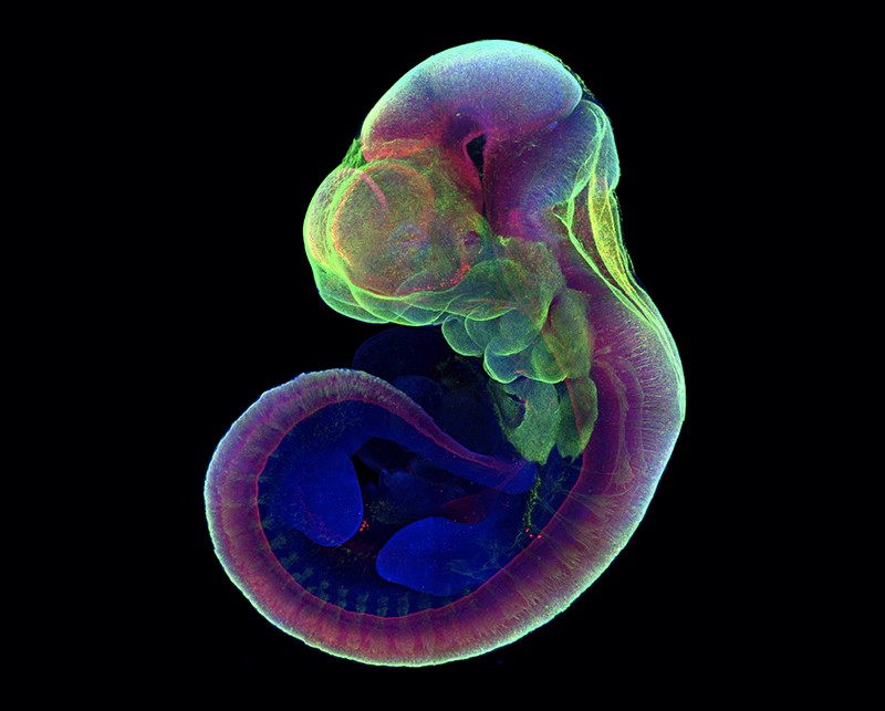 The next frontier for human embryo research - 3 Quarks Daily