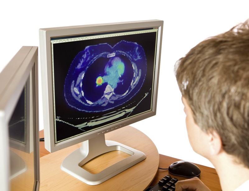 Innovations to detect cancer at its origin - 3 Quarks Daily