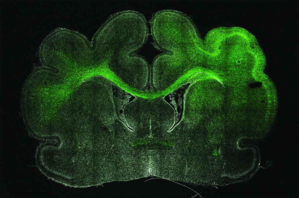 ‘Breakthrough’ finding shows how modern humans grow more brain cells ...