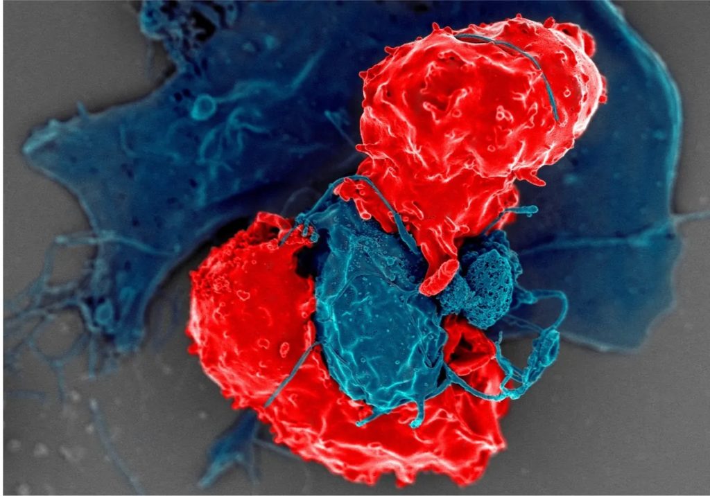 Gut Bacteria Help T Cells Heal Muscle - 3 Quarks Daily