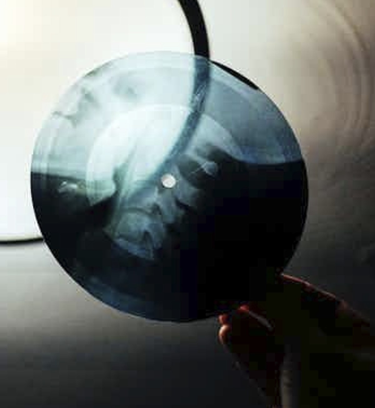 When Elvis and Ella were pressed onto X-rays – the subversive legacy of ...