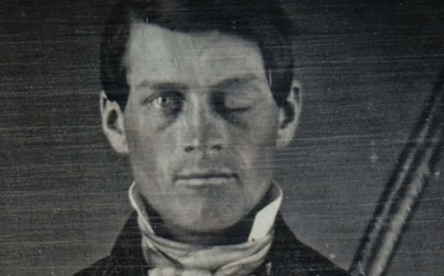 The misunderstood story of Phineas Gage shows that we need a new way of ...