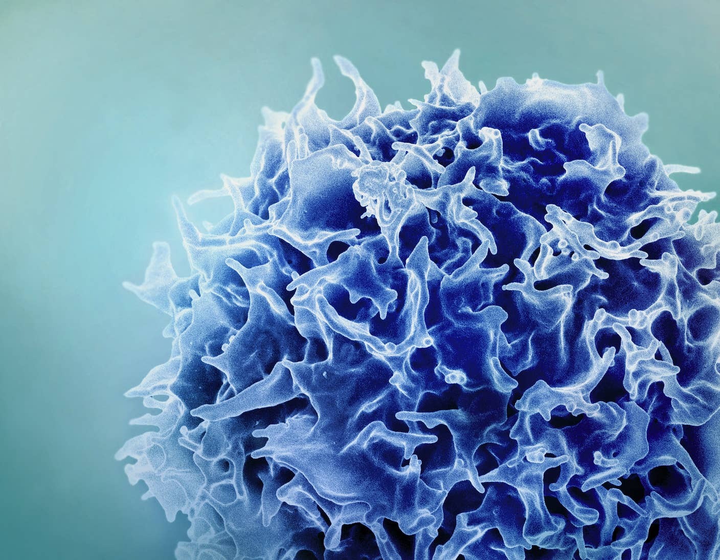 Single Injection Transforms the Immune System Into a Cancer-Killing ...